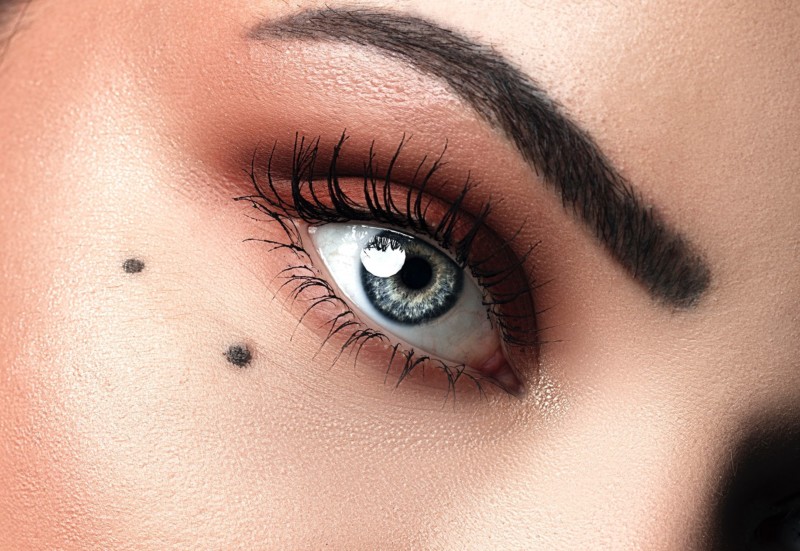 Tiny Moles Growing in a Cluster: Could this Mean Melanoma? » Scary Symptoms