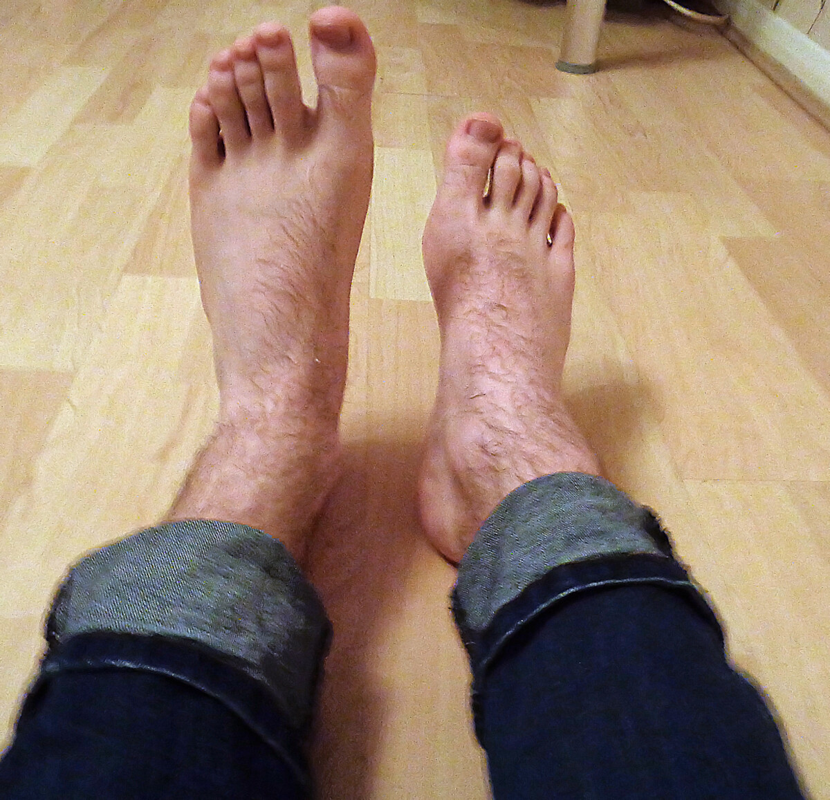 Foot Drop, No Other Symptoms: ALS or Brain Tumor? » Scary Symptoms