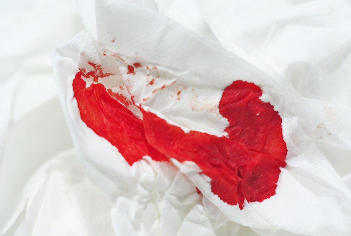 Red Stools from Beets vs. from Blood: Comparison » Scary Symptoms