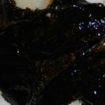 Black or Tarry Stools from Cancer vs. from Food or Drugs » Scary Symptoms