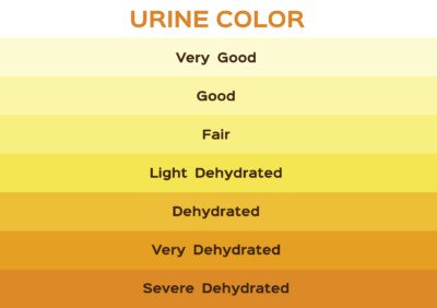 Orange Urine vs. Dark Yellow: Telling the Difference » Scary Symptoms