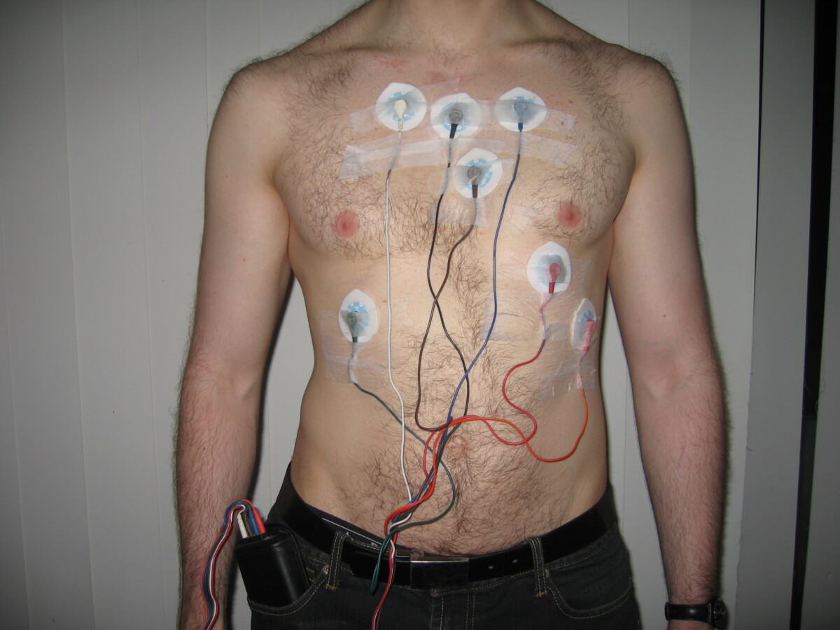 Heart Palpitations Lasting Daily, Sometimes Hours » Scary Symptoms