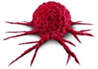 Doctors Explains How Fast Uterine Cancer Grows » Scary Symptoms