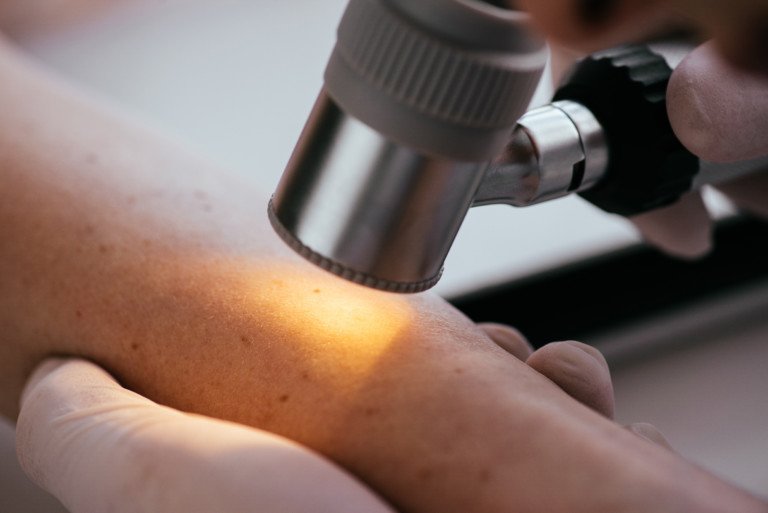 What Is a Dermatoscope? » Scary Symptoms