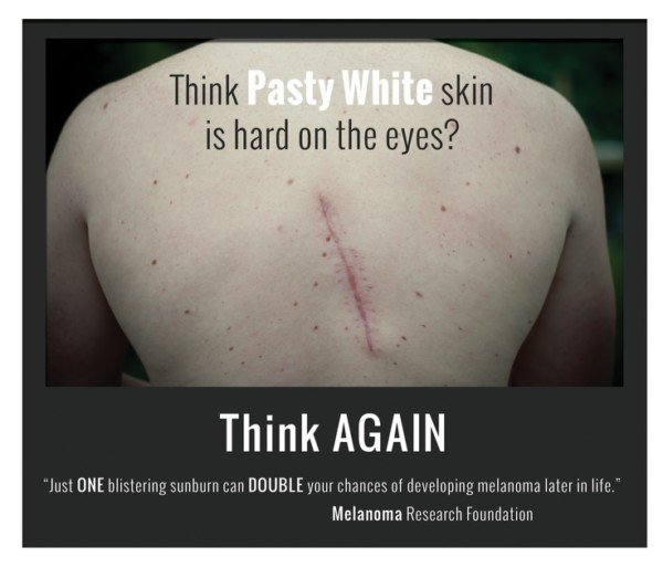 Melanoma: How Not to Let This Deadly Skin Cancer Get Past You » Scary ...