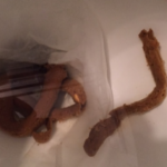 Ribbon Stools Caused by IBS vs. by Colon Cancer: Comparison » Scary ...