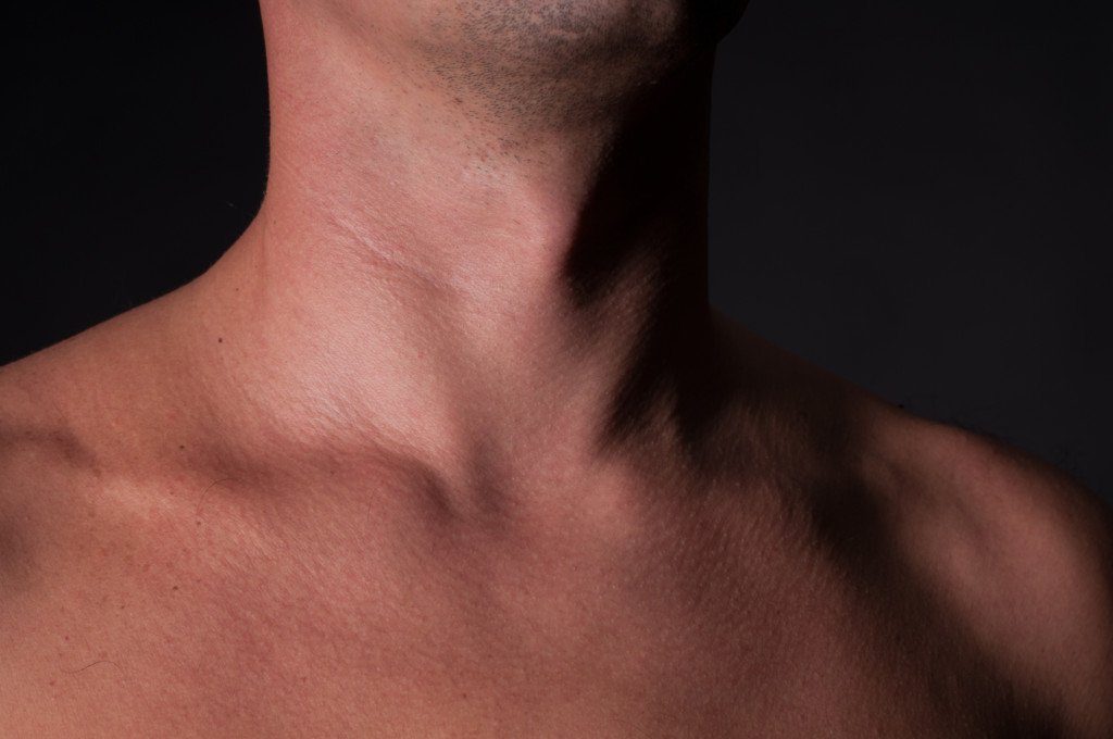 Can Cancer Cause Asymmetrical or Uneven Adam's Apple? » Scary Symptoms