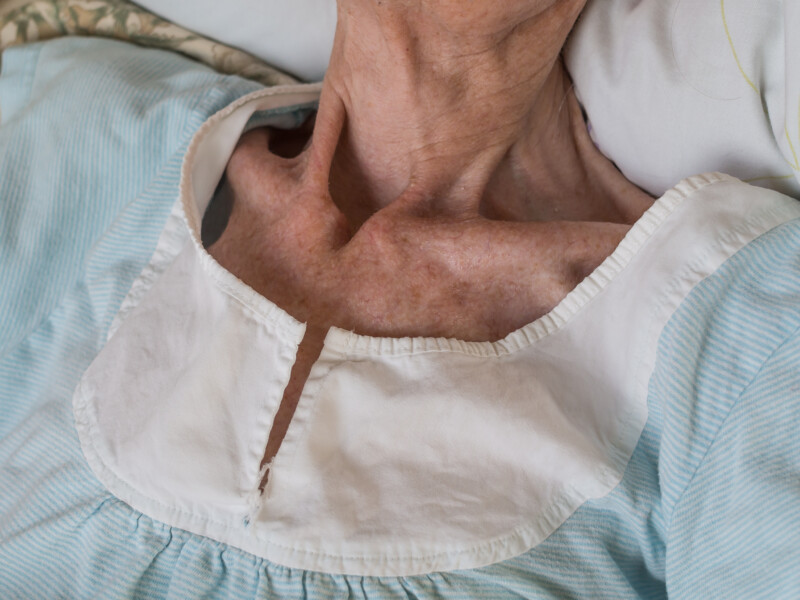 Why Are Many Elderly Women So Alarmingly Thin? » Scary Symptoms