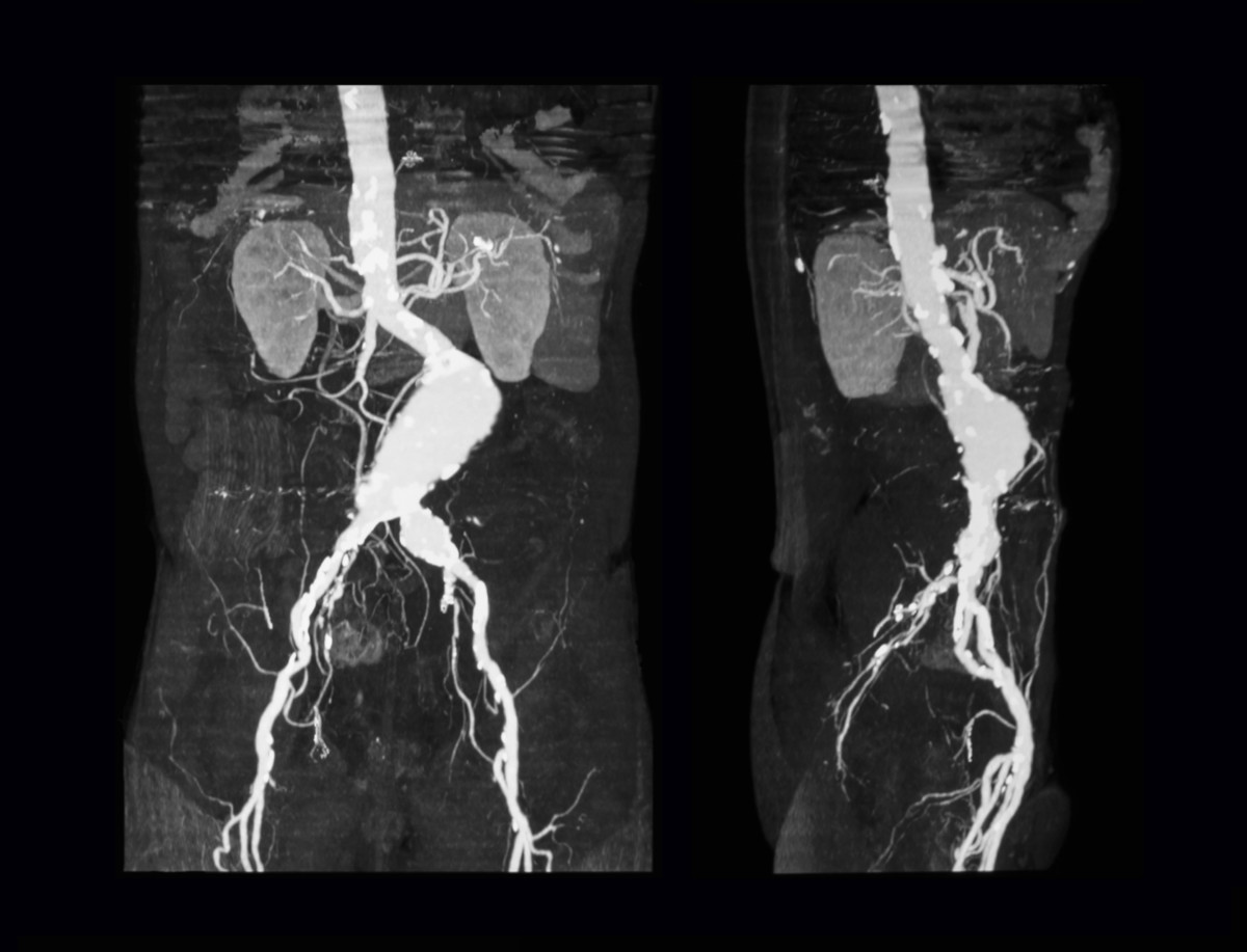 How Dangerous Is Feeling a Pulse in Your Stomach? » Scary Symptoms