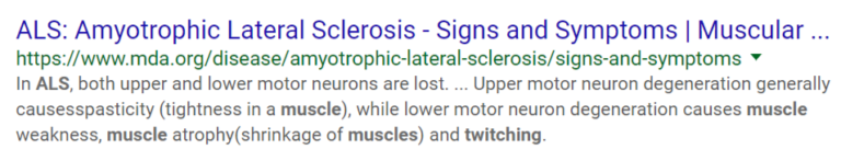 ALS vs. MS Symptoms: What Really Are the Differences? » Scary Symptoms