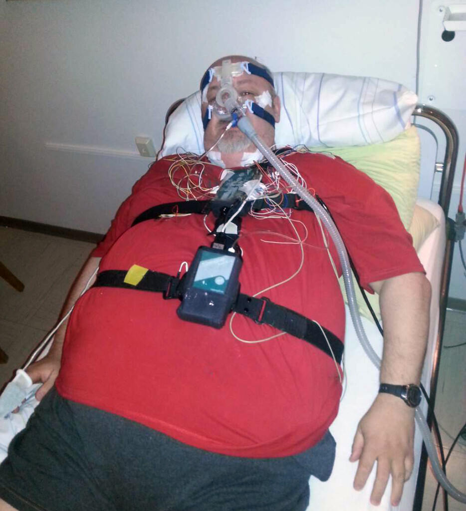 How Long Can You Live With Untreated Sleep Apnea? » Scary Symptoms