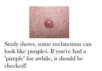 Can a Pimple Form in a Mole and Does this Mean Cancer? » Scary Symptoms
