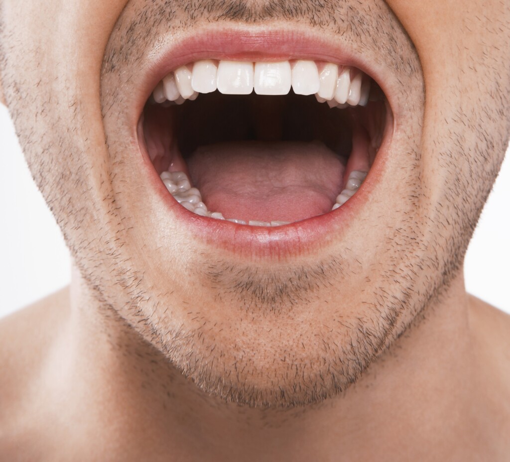 Should a Broken Molar Be Pulled? Sometimes Yes, Sometimes No » Scary ...