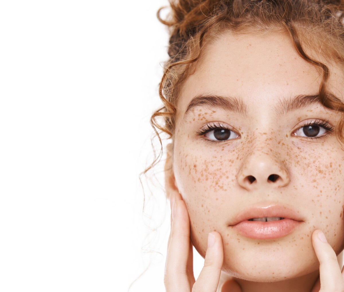How to Get More Freckles without Increasing Skin Cancer Risk? » Scary ...