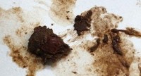Undigested Red Food in Poops vs. Drops of Blood: Comparison » Scary ...