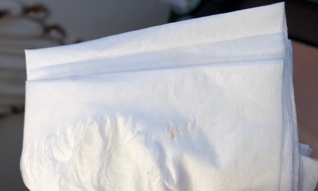 Orange Substance on Tissue Paper after Wiping: Likely Cause » Scary ...