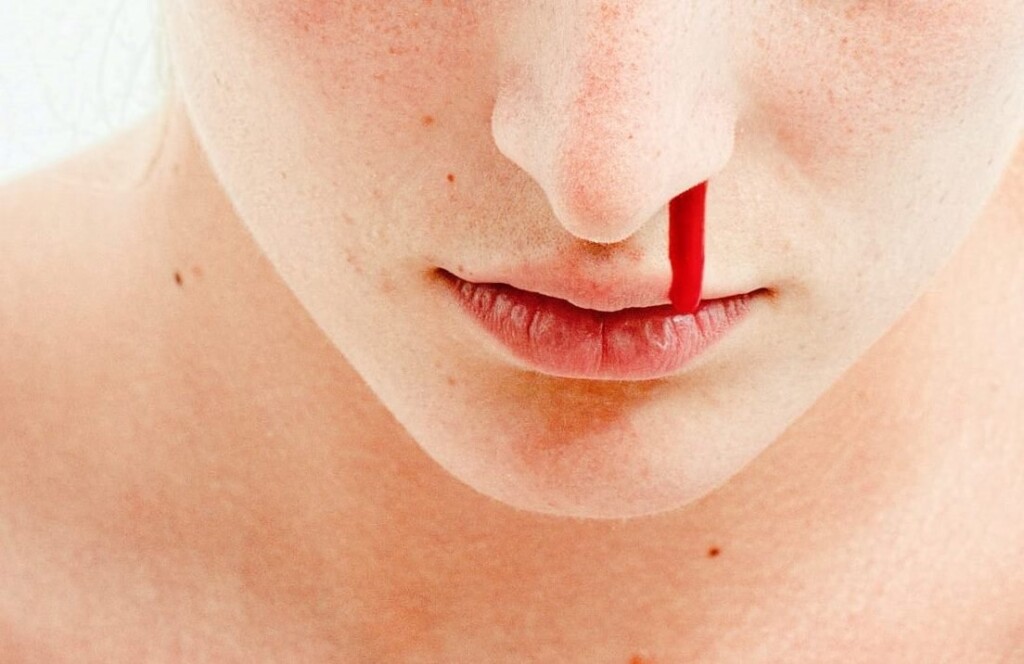 Can A Stroke Or TIA Cause A Nosebleed Scary Symptoms