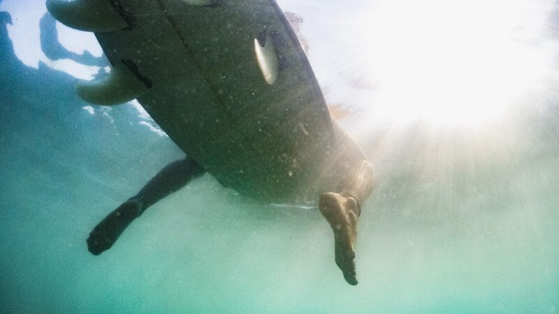 Why Do Shark Attack Victims Die a Day or Two Later? » Scary Symptoms